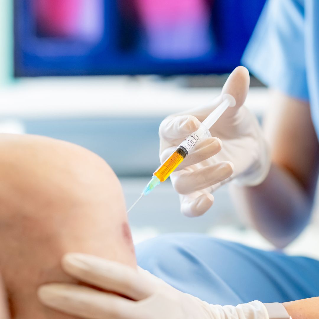 Joint Injections - Medical Clinic St Albans